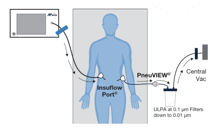 Lexion CO2 insufflatoren - Sacomed
